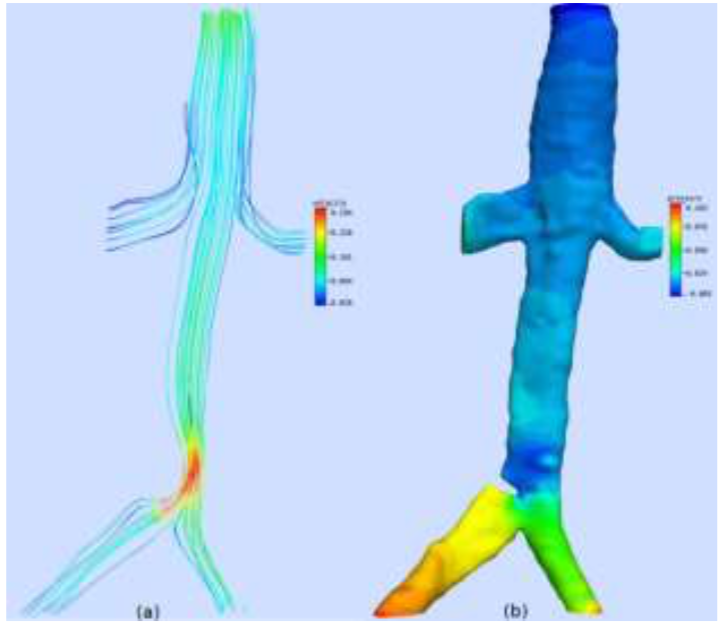 CAE Success Stories about Engineering Simulations with OpenFOAM in the ...